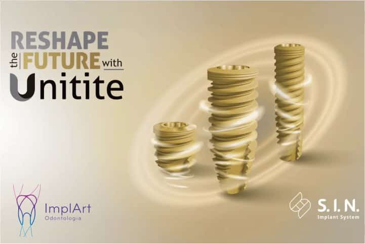 Implantes Dentários SIN | ImplArt - Conheça o novo implante!