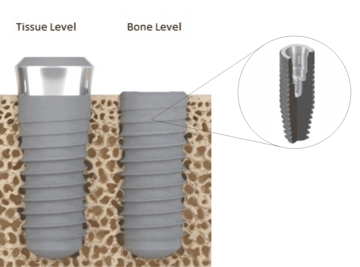 bone_level_x_tissue_level2 - ImplArt