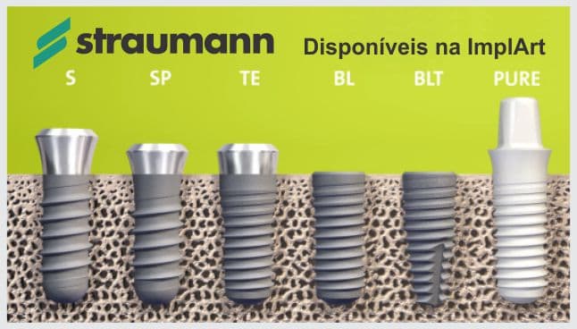 straumann_implantes_35kb - ImplArt