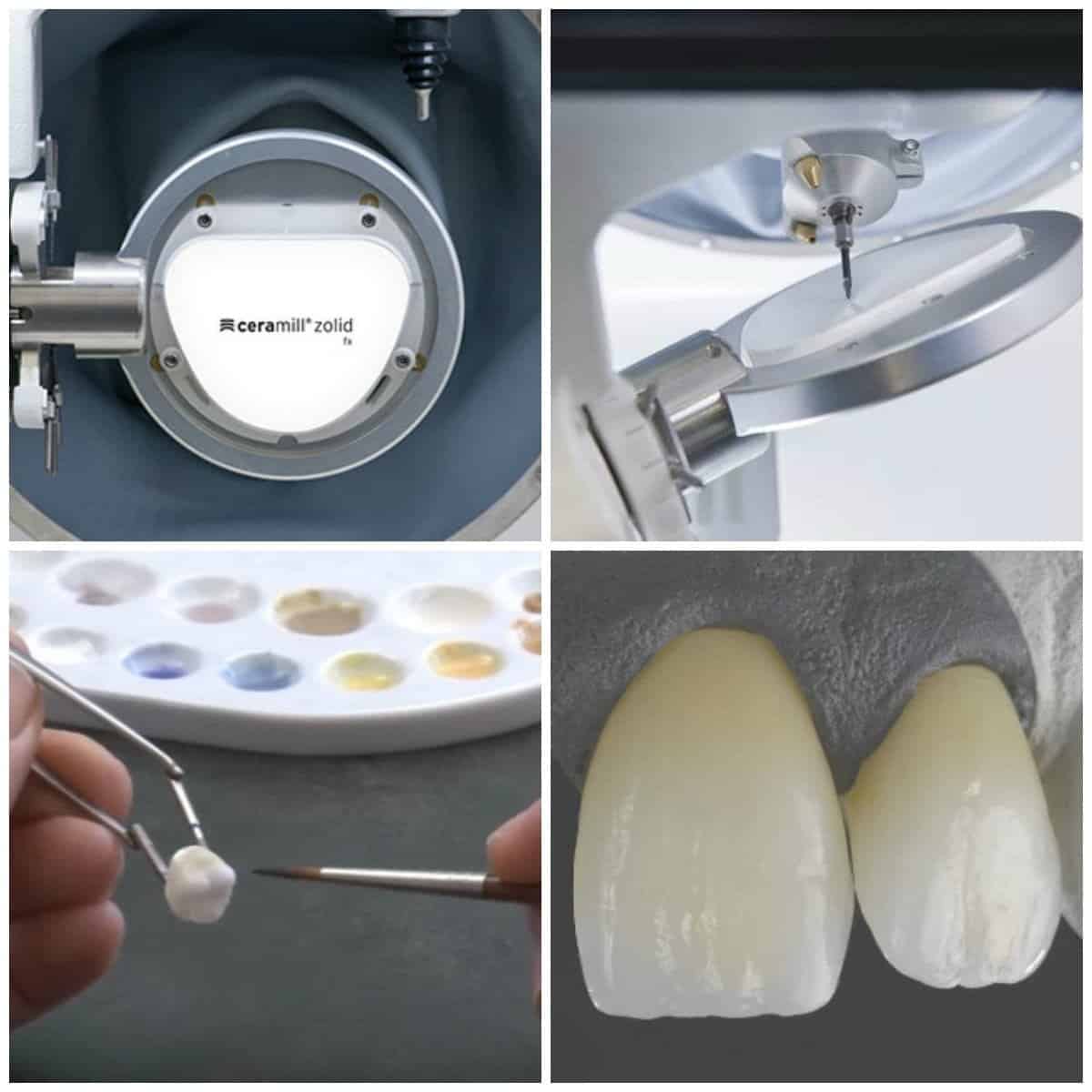 zolid_FX_passo_a_passo_2 - ImplArt