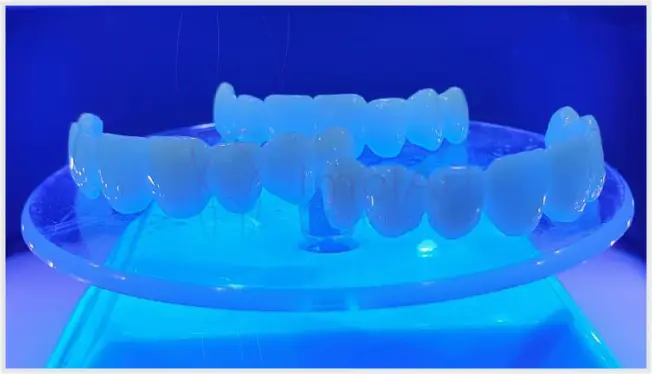 Dentes provisórios: como e porque são usados - ImplArt Implantes