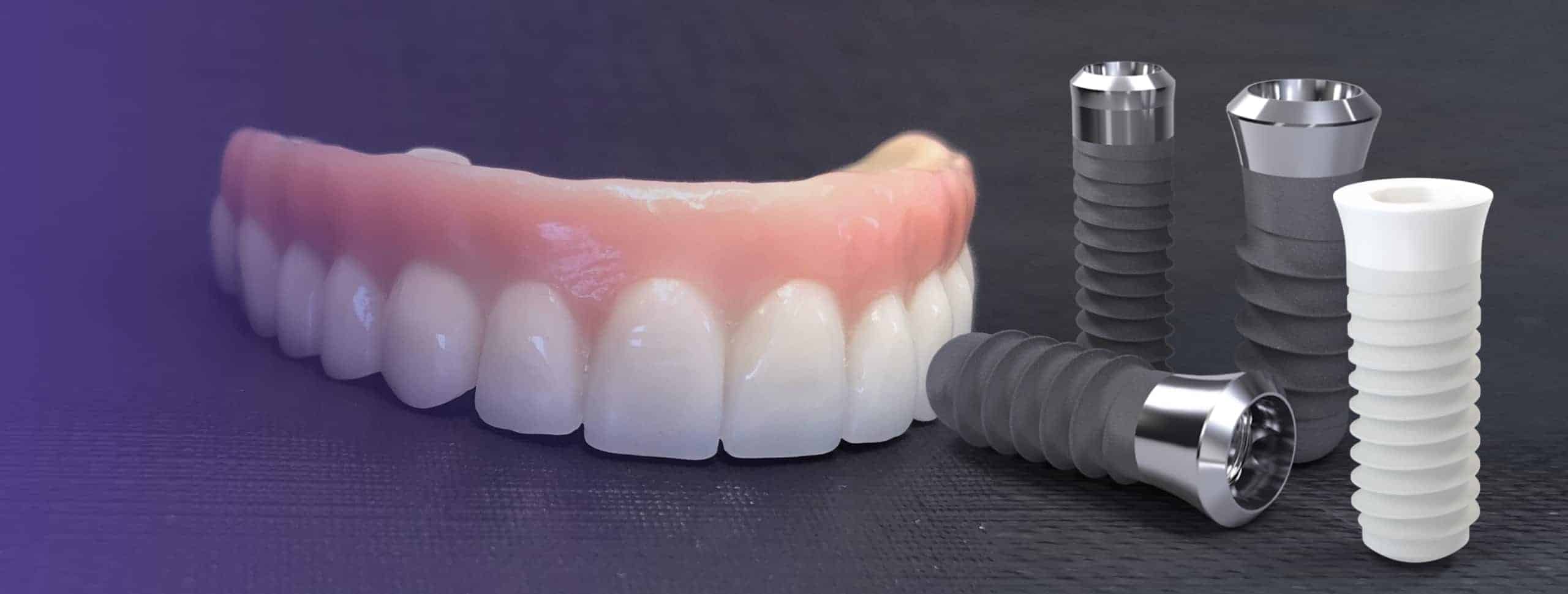 4_guia_completo_de_implantes_490kb - ImplArt