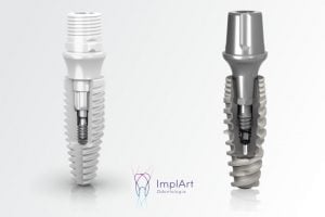 implante_ceramico_x_titanio_50kb - ImplArt