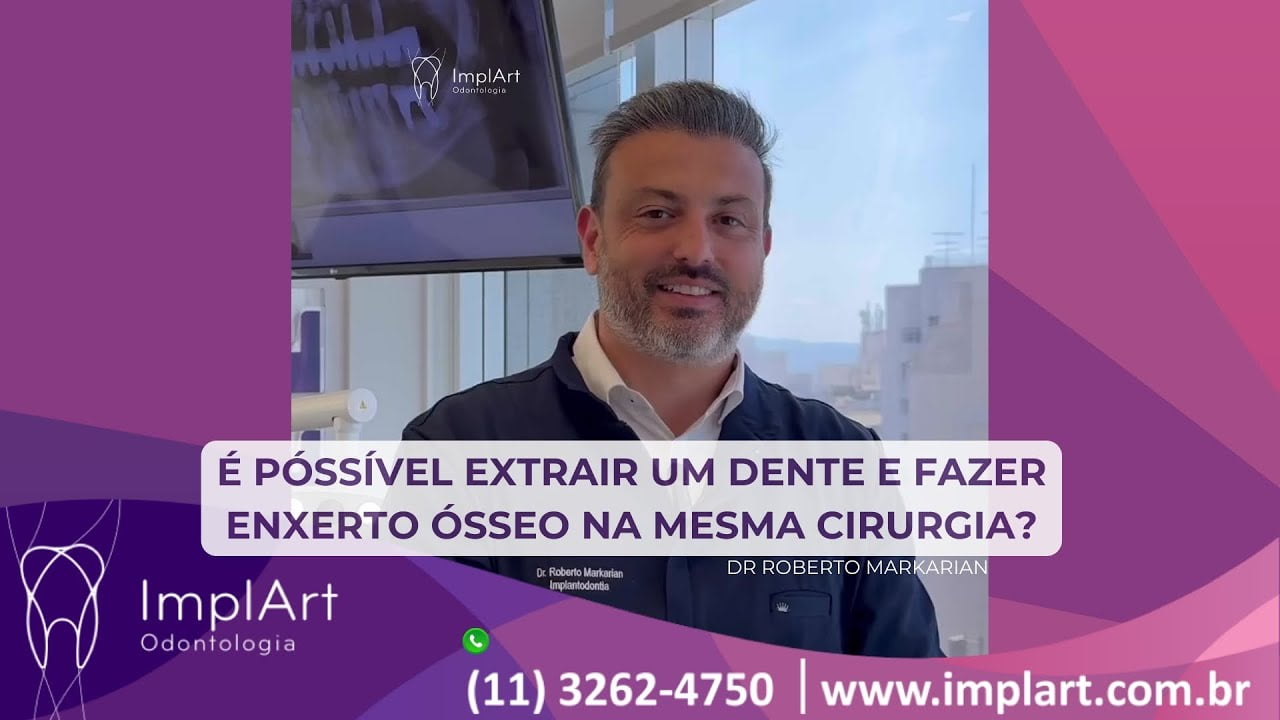 Miniatura do vídeo: QUER FAZER IMPLANTE DENTARIO EXTRAÇAO E ENXERTO ... Miniatura do vídeo: QUER FAZER IMPLANTE DENTARIO EXTRAÇAO E ENXERTO ...